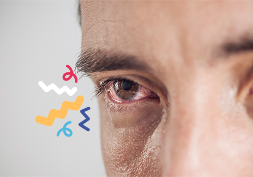 Conjonctivite : comment soigner une conjonctivite avec ou sans ...