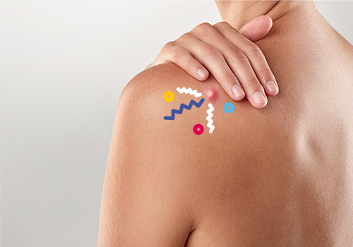 Furoncle: comment soigner un furoncle avec ou sans antibiotiques ...